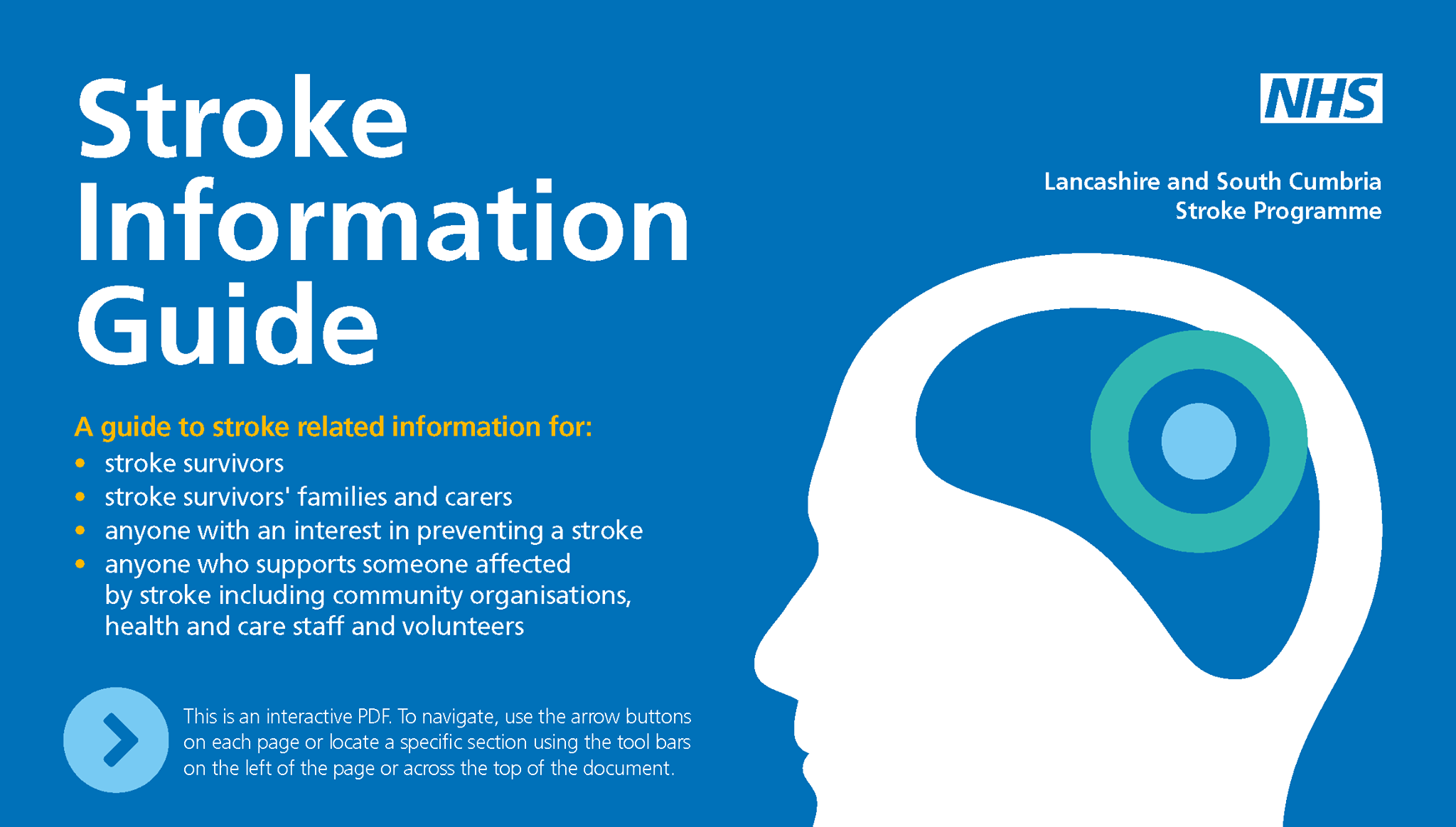 Transforming stroke care through patient engagement in Lancashire and ...